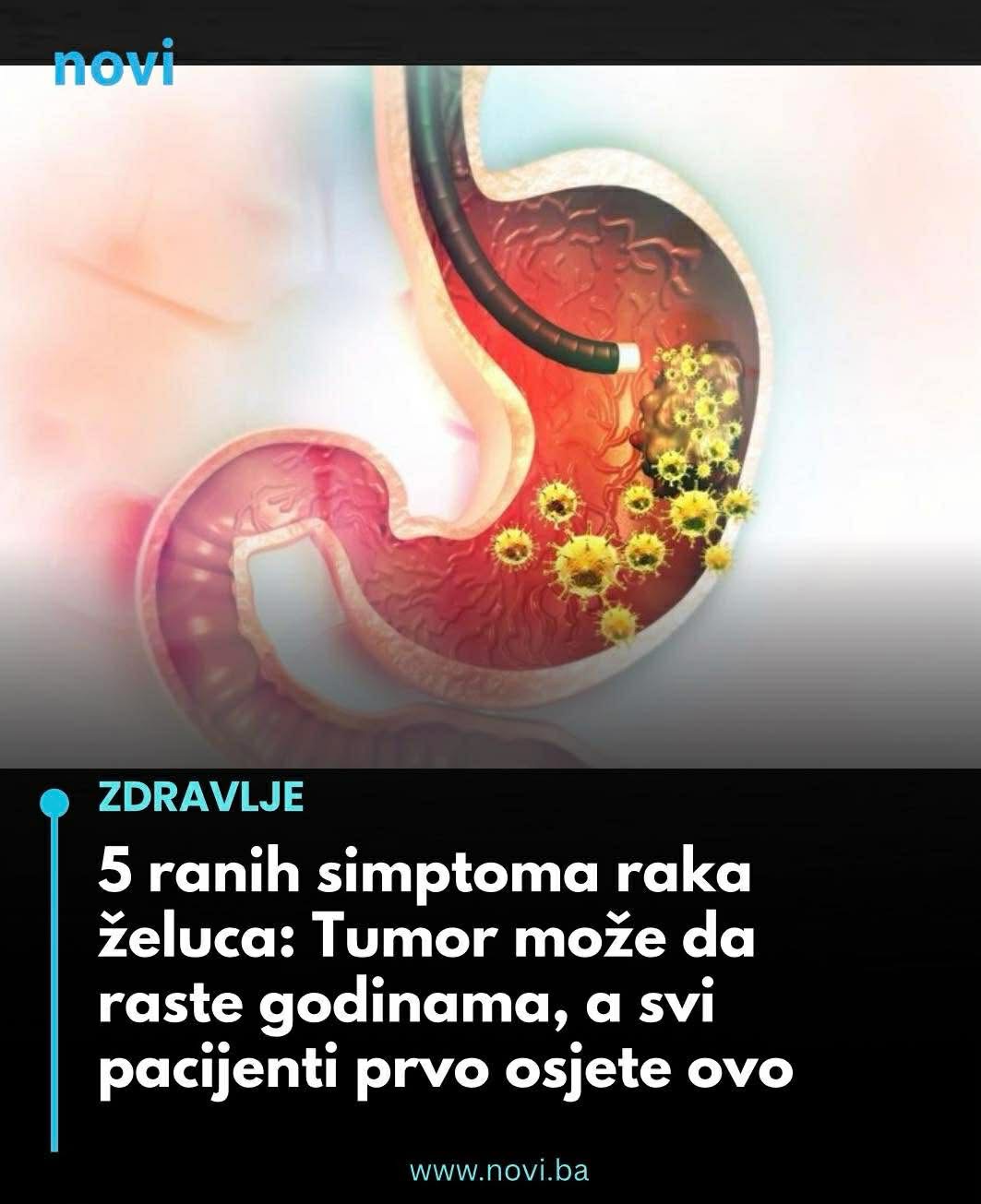 5 Ranih Simptoma Raka Želuca Koje Ne Smijete Ignorisati – Magazin M
